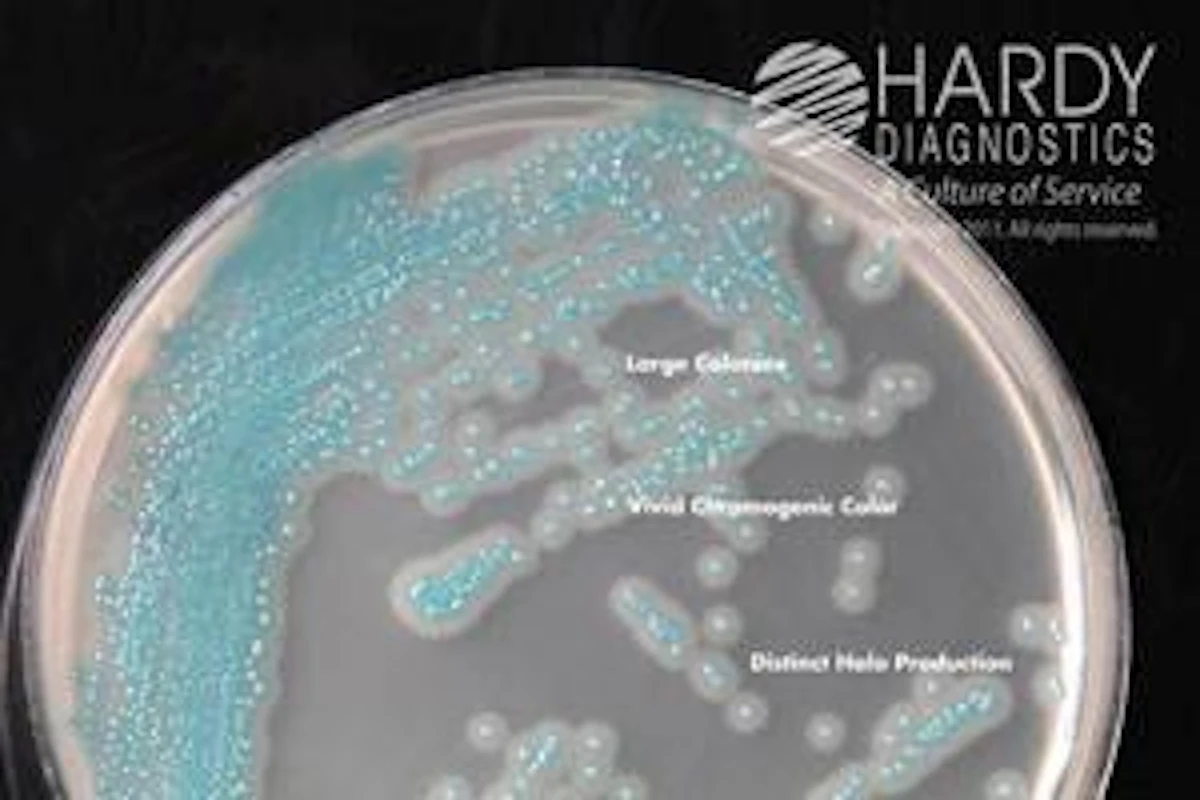Hardy Diagnostics HardyCHROM Listeria From: Hardy Diagnostics ...